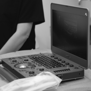 Radiofrequency Ablation (RFA) | McKeown Medical